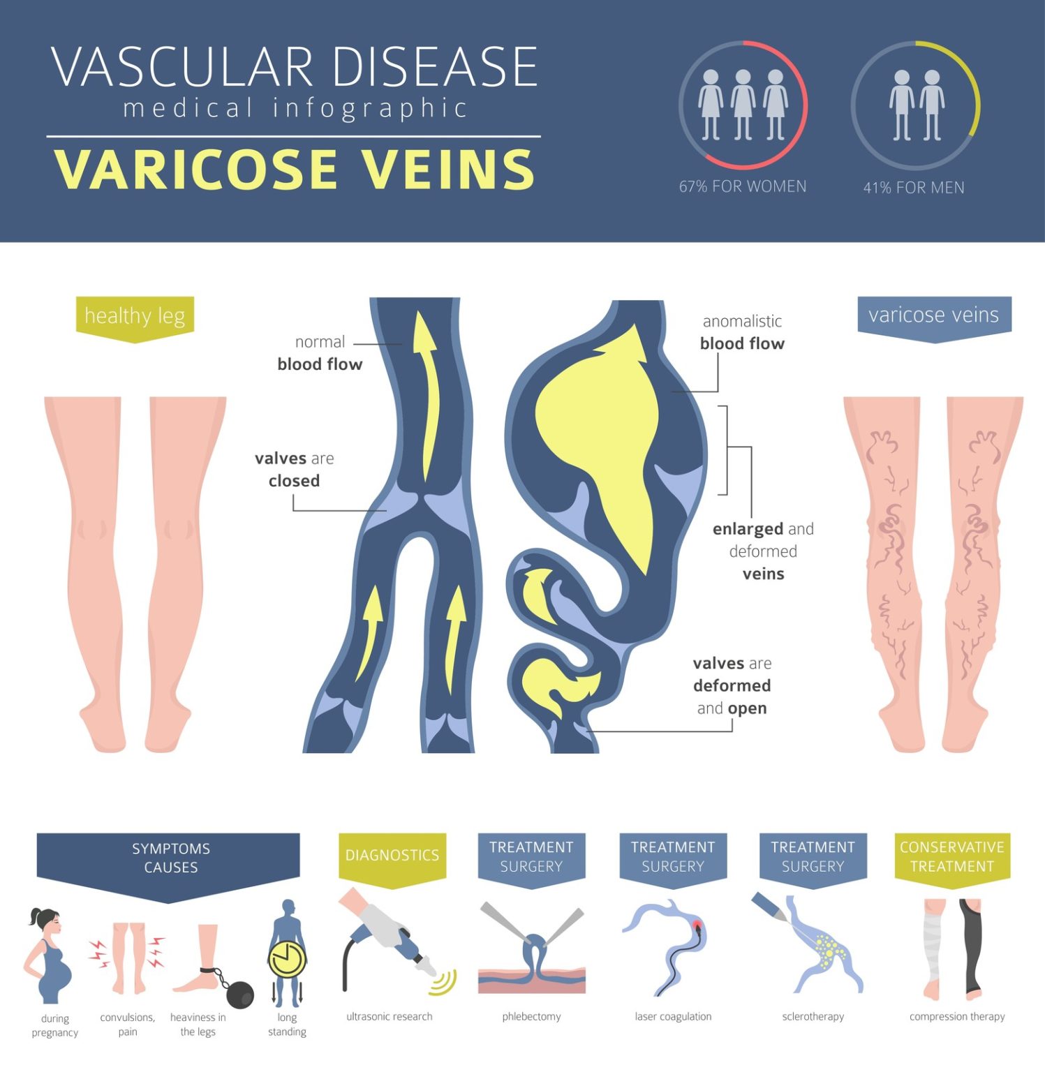 Phlebectomy - San Diego Vein Specialists
